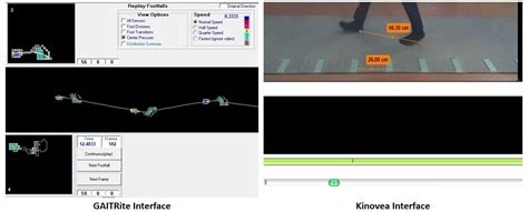 Agreement Between Gaitrite And Conventional Gait Assessment Tools Which Can Be Utilized In
