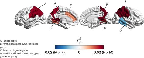 Sex Differences In Brain Structure Are Present From Birth Research Shows
