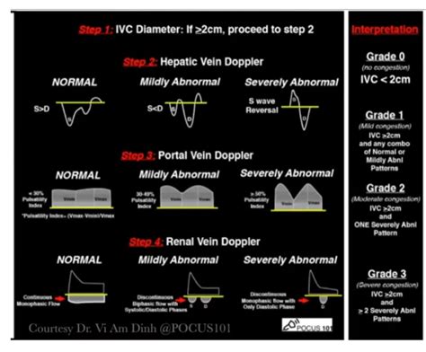 Today I Review Link To And Excerpt From EMCrit S EMCrit Panel Quadrant Hemodynamic