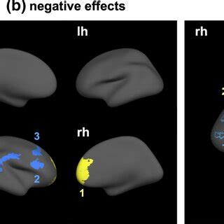 Sexindependent Effects Of Early Life Stress On Vertexwise LGI Download Scientific Diagram