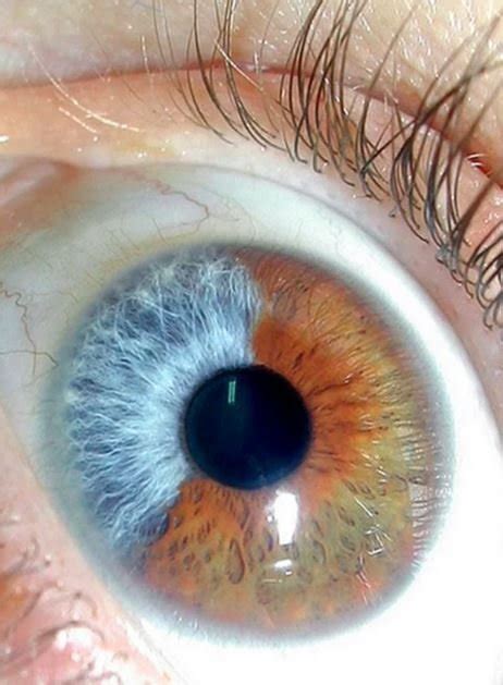 აი ის თვალები ულამაზესი თვალები მსოფლიოს სხვადასხვა ქვეყნებიდან