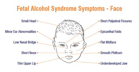 Fetal Alcohol Syndrome Statistics Uk