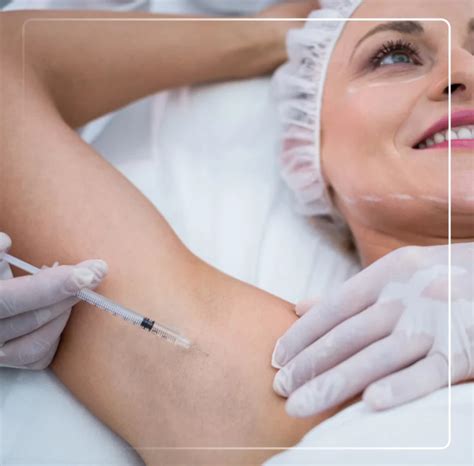 Hiperhidrosis Yh Clinics