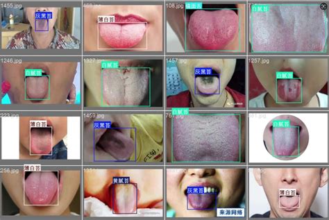 基于yolo的中医舌苔自动识别系统 五类舌象精准检测【含完整数据训练源码】 申公豹本豹 博客园