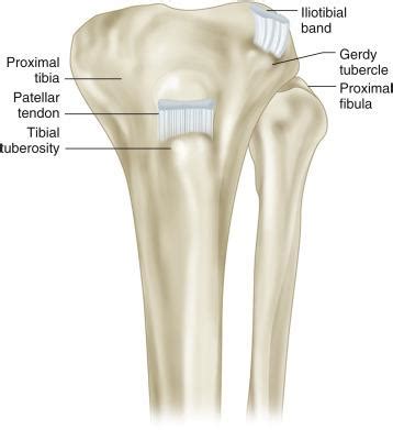 Tibial Tuberosity Attachment