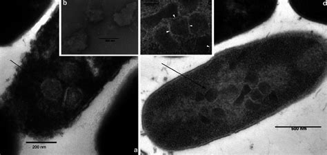 L Reuteri 20016 Produces Metabolosomes A Cell Section Electron