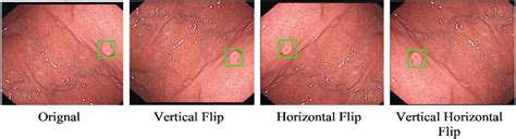 Image Augmentation Using Clodsa Download Scientific Diagram