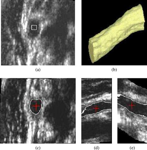 Figure 12 From Robust Adaptive Segmentation Of 3d Medical Images With