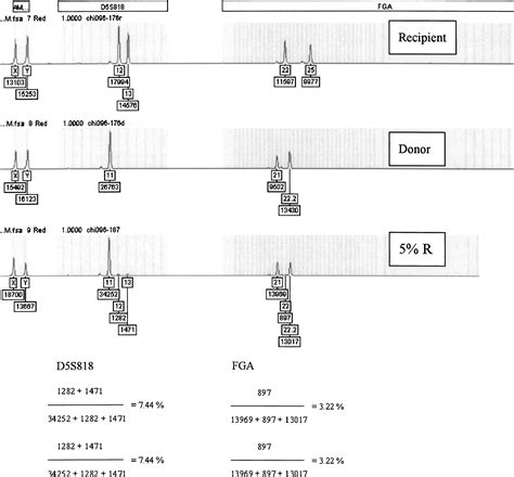 Systematic Analysis Of Stutters To Enhance The Accuracy Of Chimerism Testing