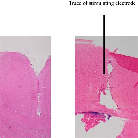 Exemplary Photomicrograph Illustrating Places Of Stimulating And Download Scientific Diagram