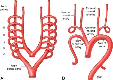 Figure 2 From The Many Faces Of Persistent Stapedial Artery Ct