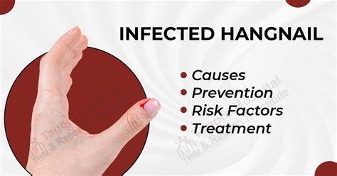 Hangnail Infected Hangnail Causes Treatment And More