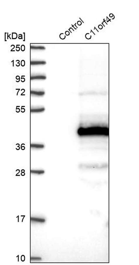C11orf49 Polyclonal Antibody Invitrogen 100 μl Unconjugated
