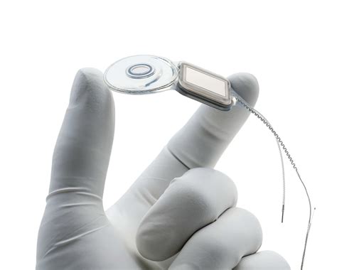 ¿cómo Es Una Cirugía De Implante Coclear