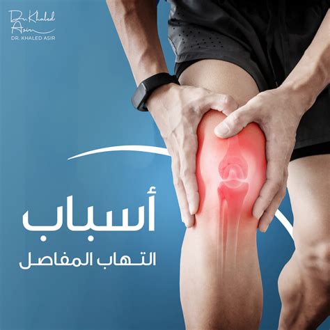 Dr Khaled Asir مرض التهاب المفاصل من أكثر الأمراض