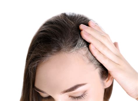 Female Hair Loss At The Temples Causes And Treatment Blog Keranique