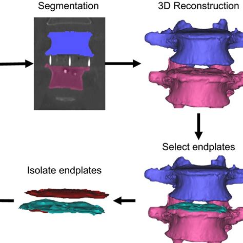 Creation Of A Three Dimensional Computed Tomography 3d Ct Download Scientific Diagram