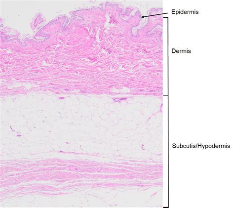 Structure Of Hypodermis