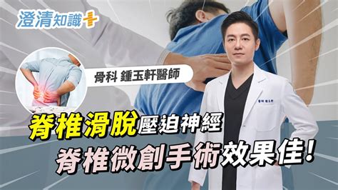 【澄清知識＋】脊椎滑脫壓迫神經 脊椎微創手術效果佳 骨科 鍾玉軒醫師 Youtube