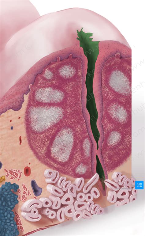 Crypt Of Lingual Tonsil 3168 Kenhub Image License Store