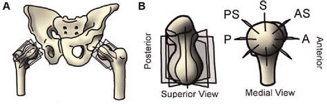 Figure 1 From Reference Values For Proximal Femoral Anatomy In