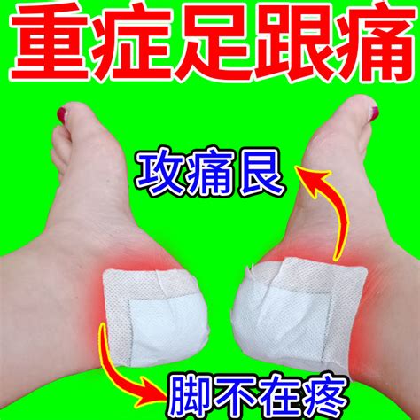 限时免费晒图1元足跟痛专用膏贴 大卖网