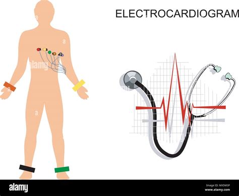 Illustration De Lélectrocardiogramme Le Patient Avec Des électrodes