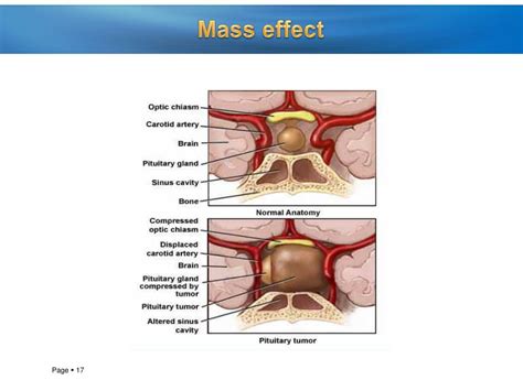 Ppt Anesthesia For Transphenoidal Hypophysectomy Powerpoint Presentation Id 611933