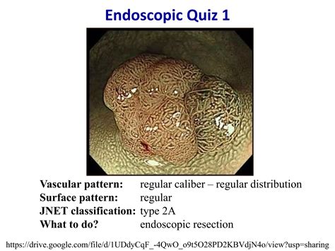 Jnet Classification Of Colo Rectal Polyps Pptx