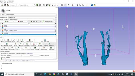 是否能添加截面使得segment由 个变为 个 问题求助 DSlicer中文论坛