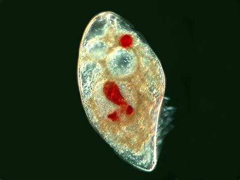 Blepharisma Under Microscope