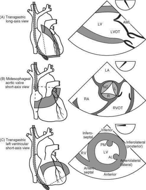 Pin On Echocardiography