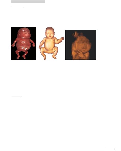 Eritroblastose Fetal