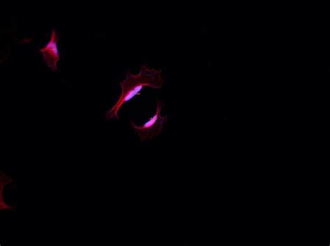 2d Automated Analysis Image Pro Media Cybernetics