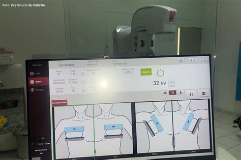 Exames De Mamografia Em Itabirito Passam A Ser 100 Digitais