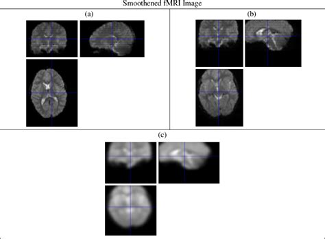 figure 4 from classification of autism spectrum disorder using resting state functional magnetic