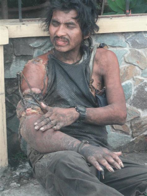 【閲覧注意】1日20回オナニーした結果・・・・・ 画像あり ポッカキットポッカキット