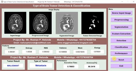 Types Of Brain Tumor Detection And Classification Using Image