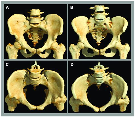 Anatomy Of The Pelvis A 3d Computed Tomography Reconstruction Ac