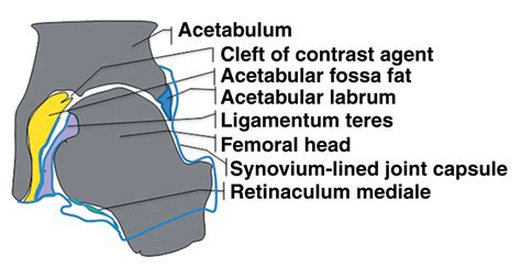 Acetabular Fossa