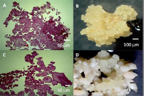Histological And Morphological Characteristics Of Indirect Somatic