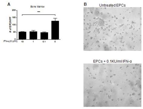 Ifn α Is Toxic To Murine Epcs Bone Marrow Epcs From Balb C Mice Were Download Scientific