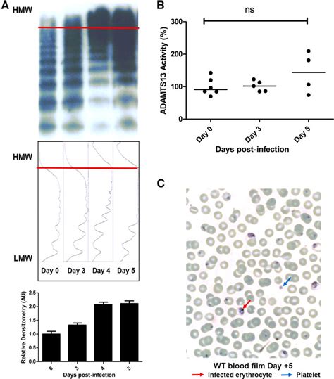Severe P Berghei Malaria Influences Plasma Vwf Multimer Composition