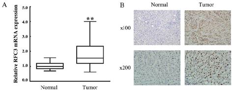 Replication Factor C Subunit 3 Rfc3 Is Overexpressed In Download Scientific Diagram