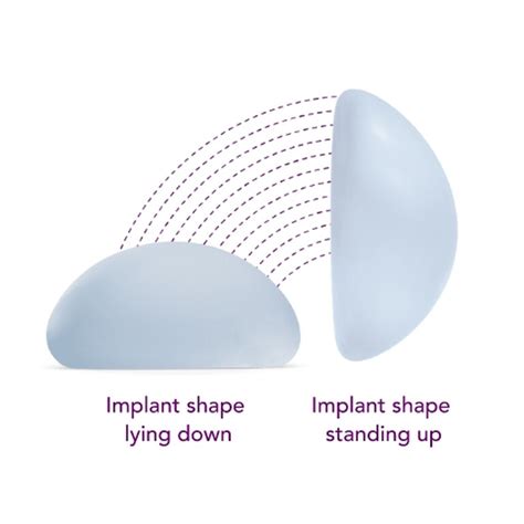 Patient Aesthetic Breast Augmentation Motiva Us