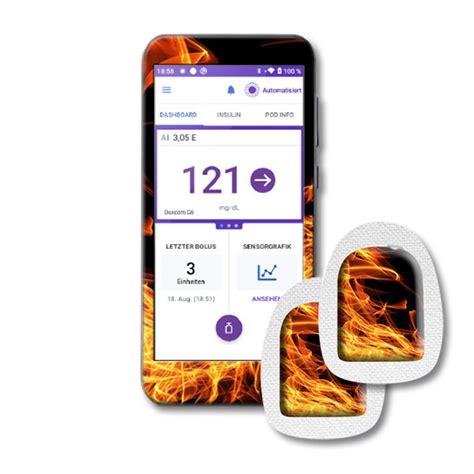 Omnipod 5 Controller Sticker Set Fire Zuckerschmuck