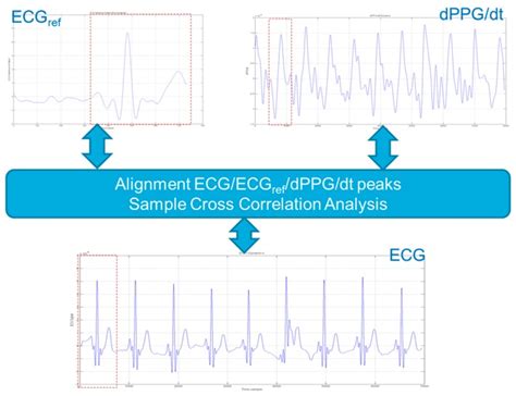 An Advanced Bio Inspired Photoplethysmography Ppg And Ecg Pattern Recognition System For