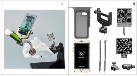 Accuracy Of Cup Placement Angle Leg Lengthening And Offset
