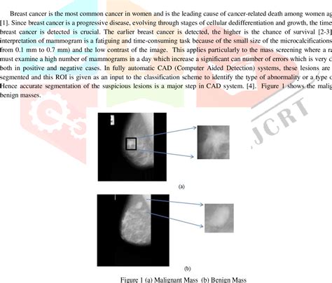 Figure 1 From Review On Mammogram Segmentation Methods Semantic Scholar