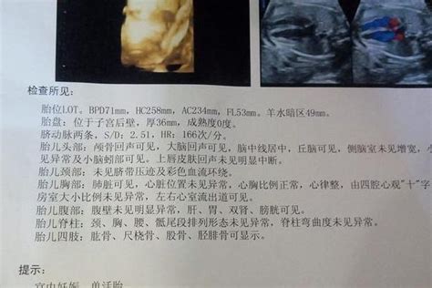 顺产62斤男宝宝，母子平安，分享一下孕期症状供参考